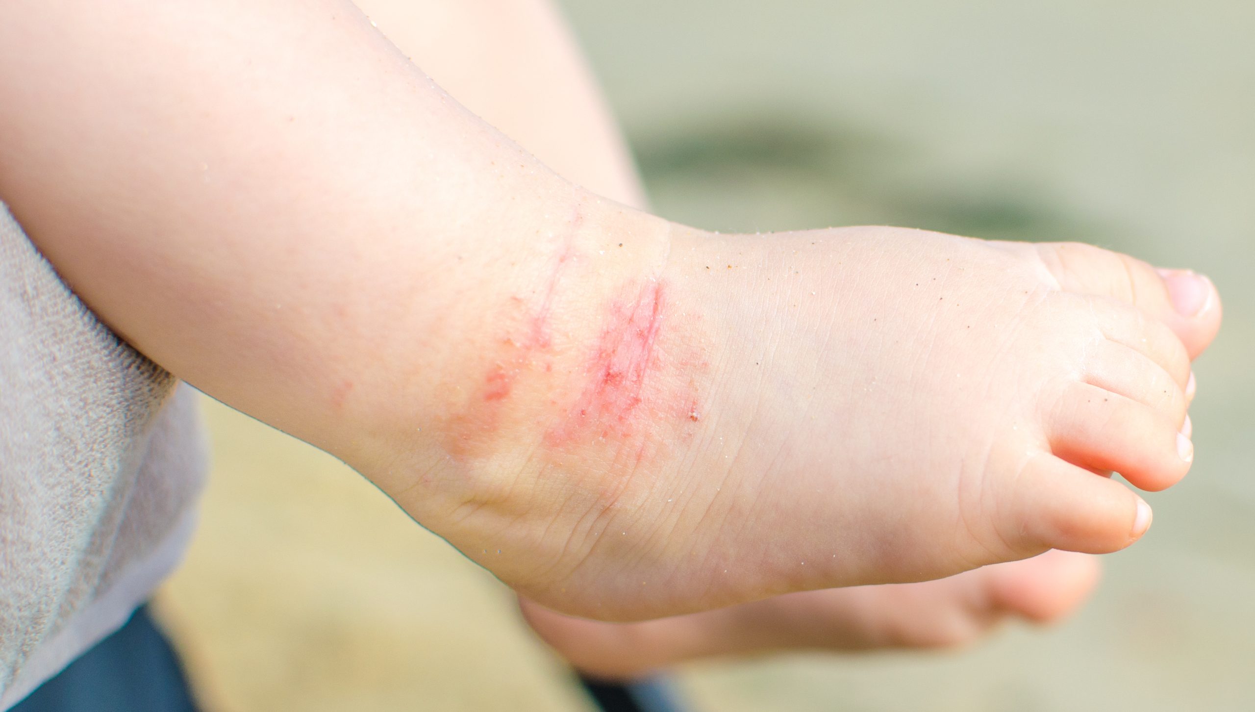 Children's Dermatology Service - Paediatric Diagnostics
